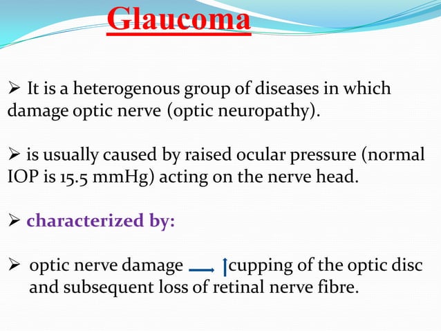 Glaucoma | PPTX