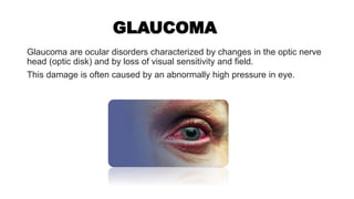 Glaucoma - DISEASE PRESENTATION | PPTX