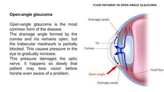 Glaucoma - DISEASE PRESENTATION | PPTX