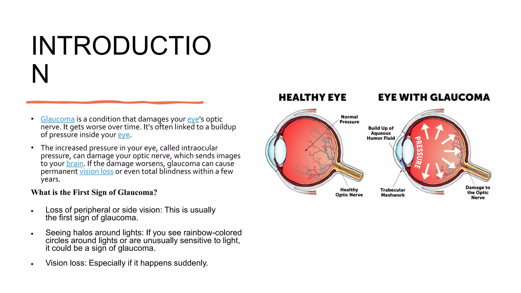 Glaucoma | PPT