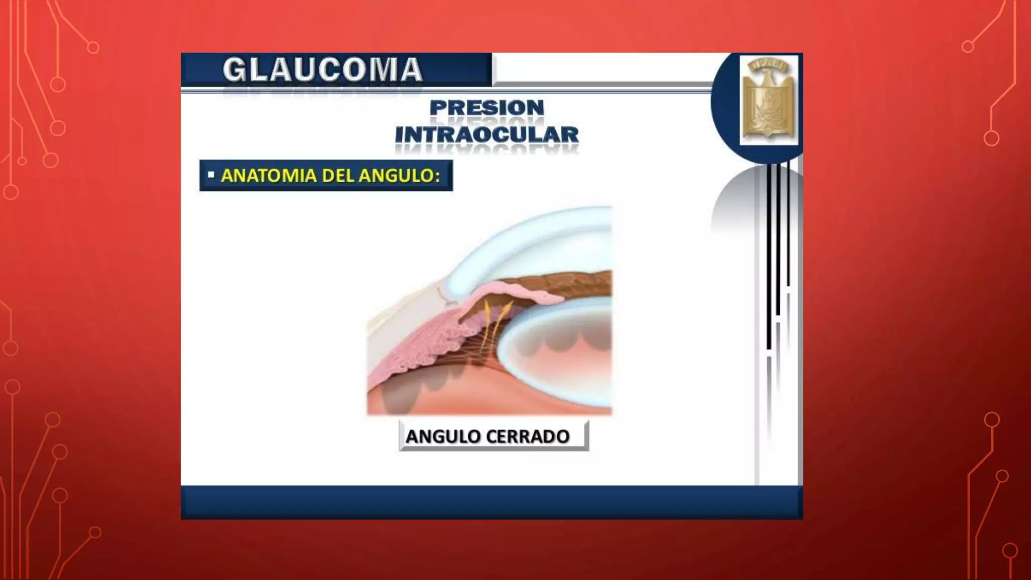 Glaucoma | PPT