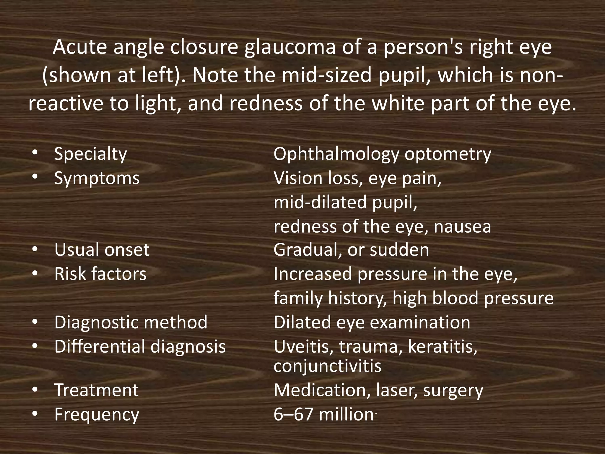 Glaucoma | PPTX