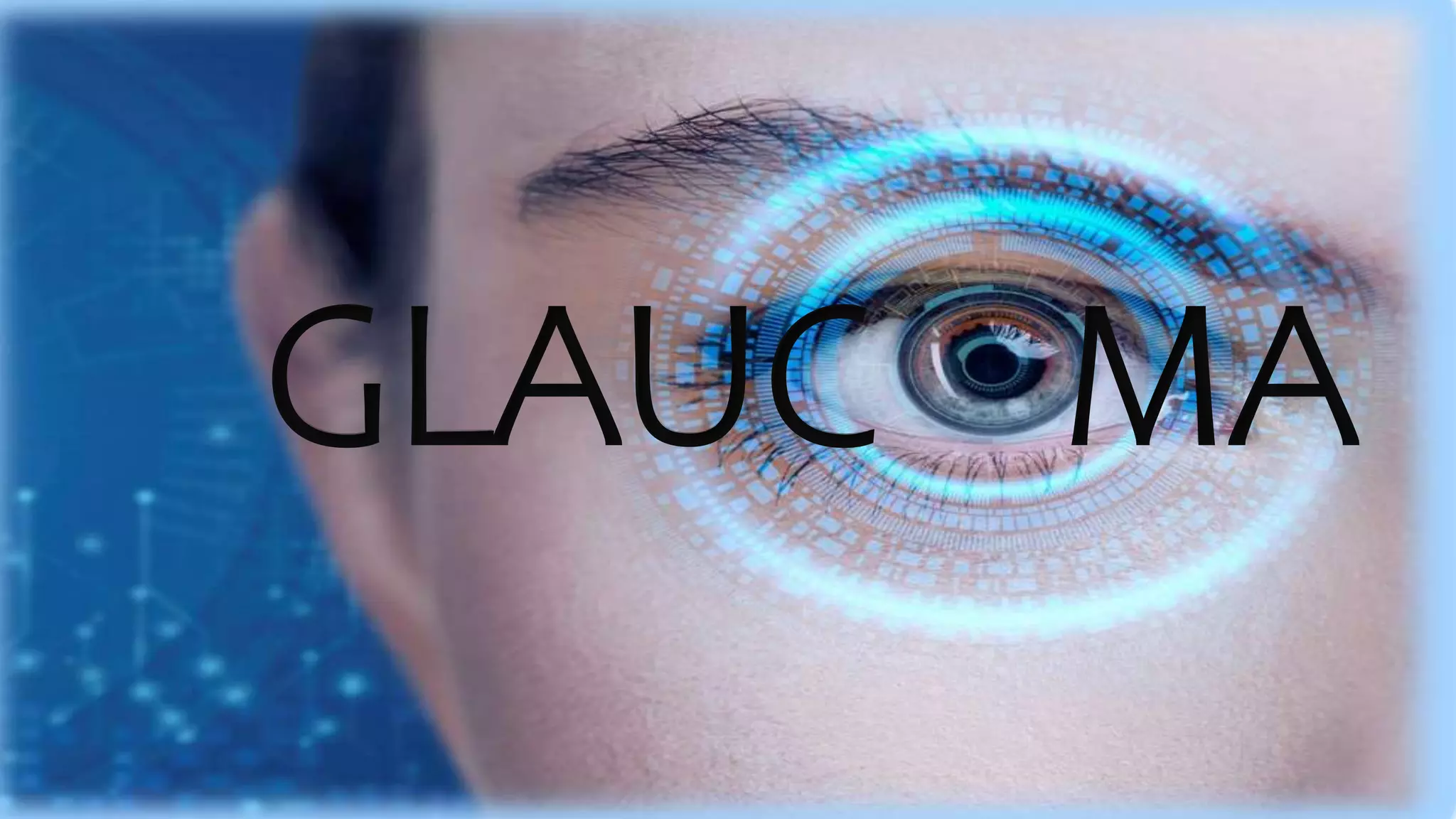 Glaucoma.pptx