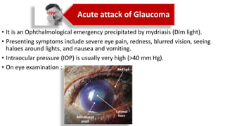 Glaucoma.pptx