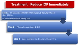 Glaucoma.pptx