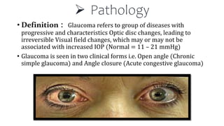 Glaucoma.pptx