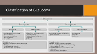 Glaucoma.pptx