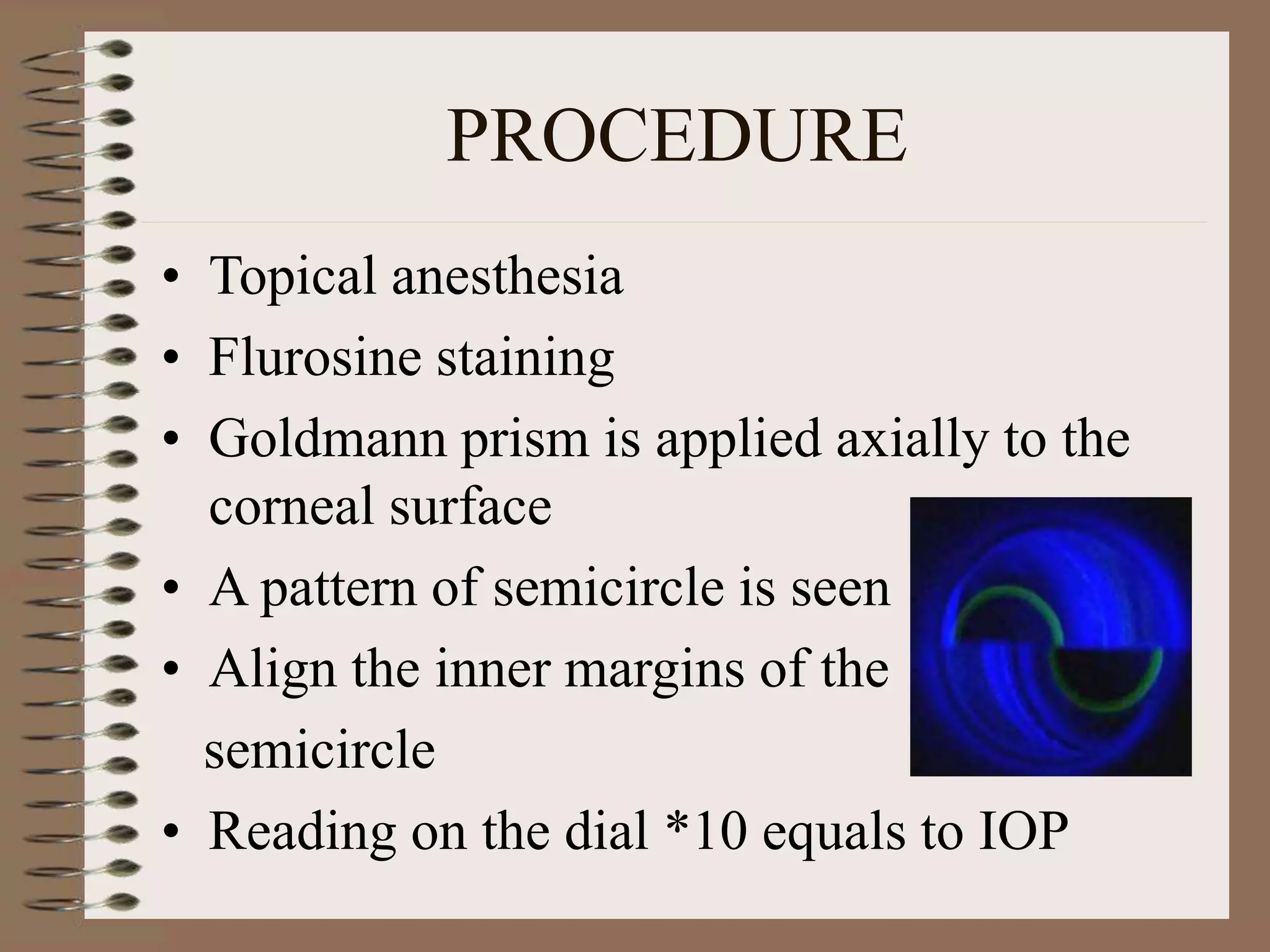 GLAUCOMA.ppt