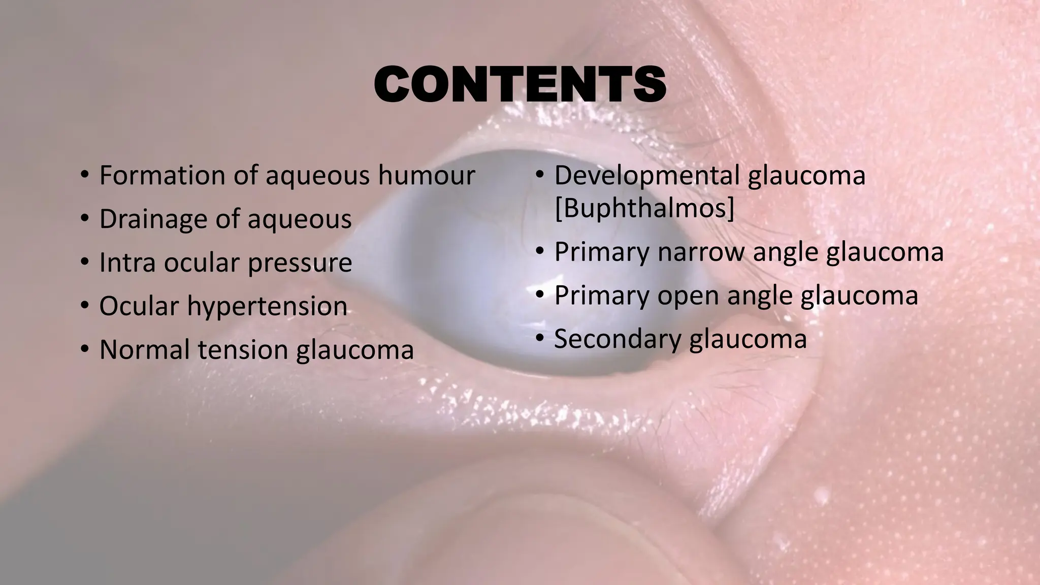 GLAUCOMA.pdf