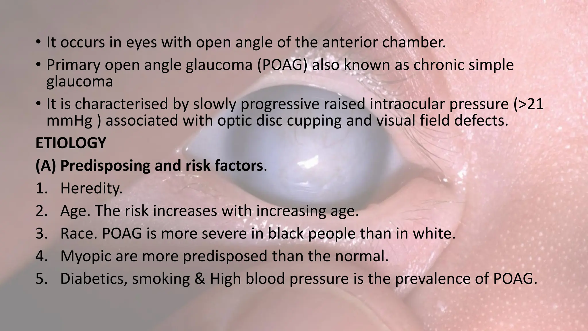 GLAUCOMA.pdf