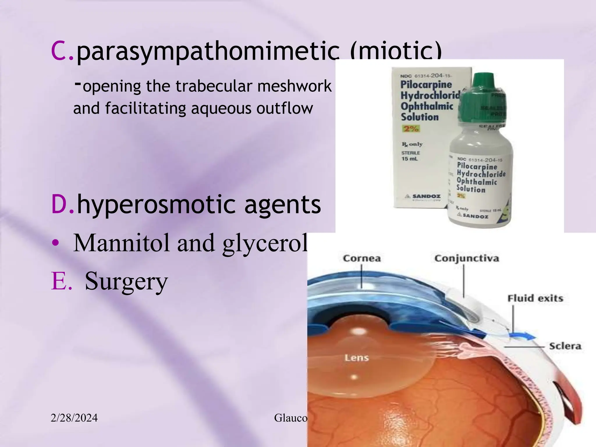 Glaucoma presentation short descriptions | PPTX | Eye and Vision ...