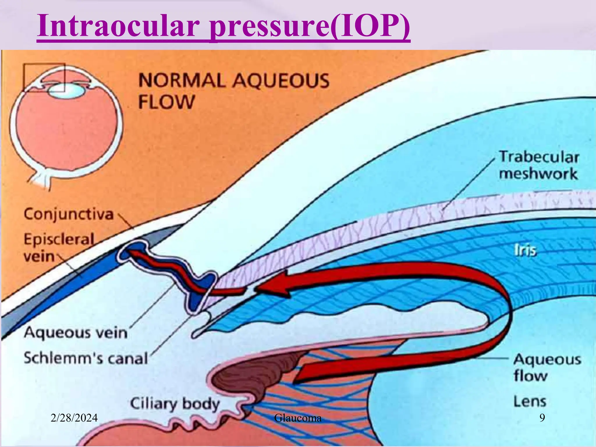 Glaucoma presentation short descriptions | PPTX | Eye and Vision ...