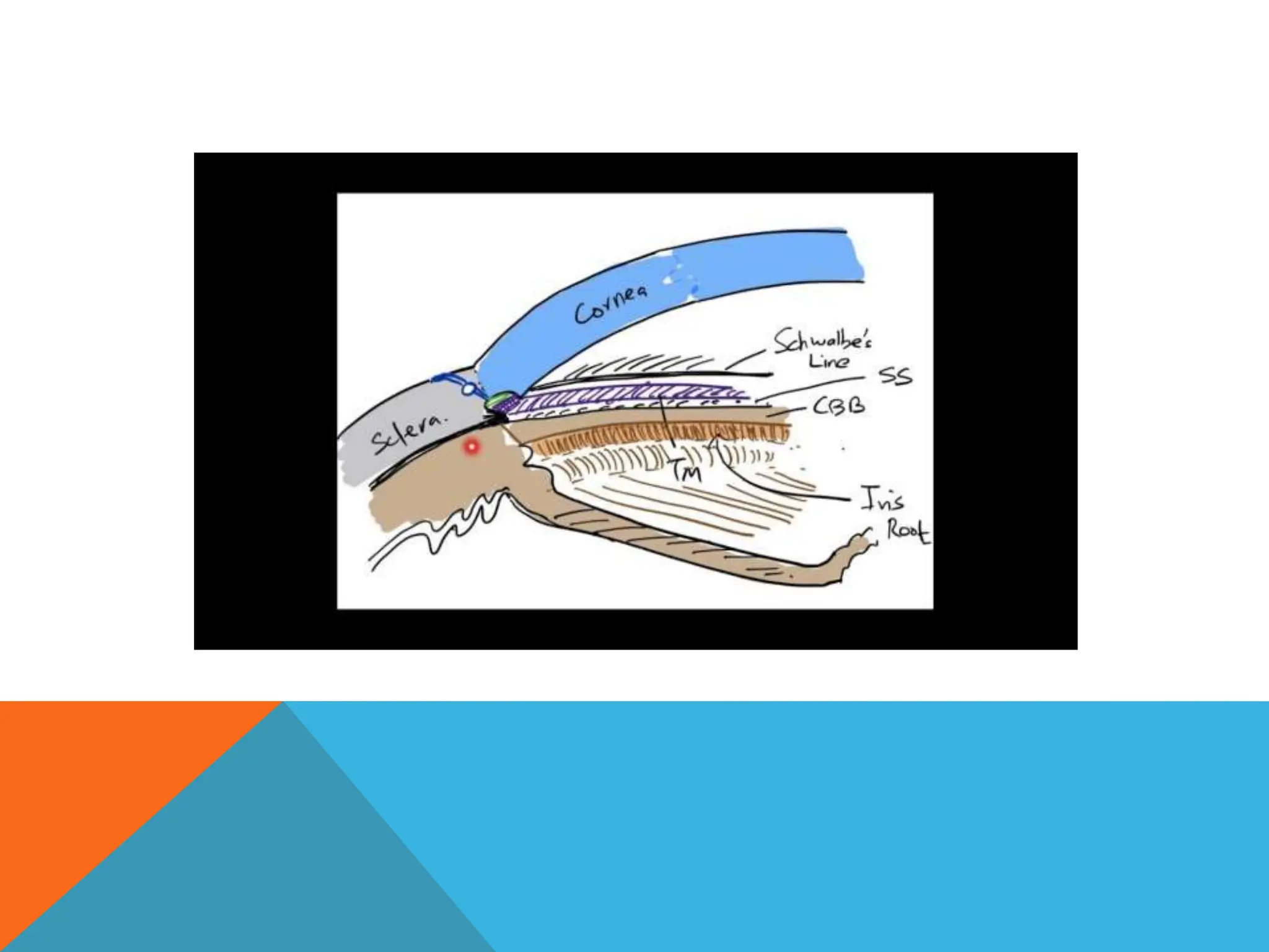 Glaucoma ophthalmology diagnosis ,signs,ttt | PPT