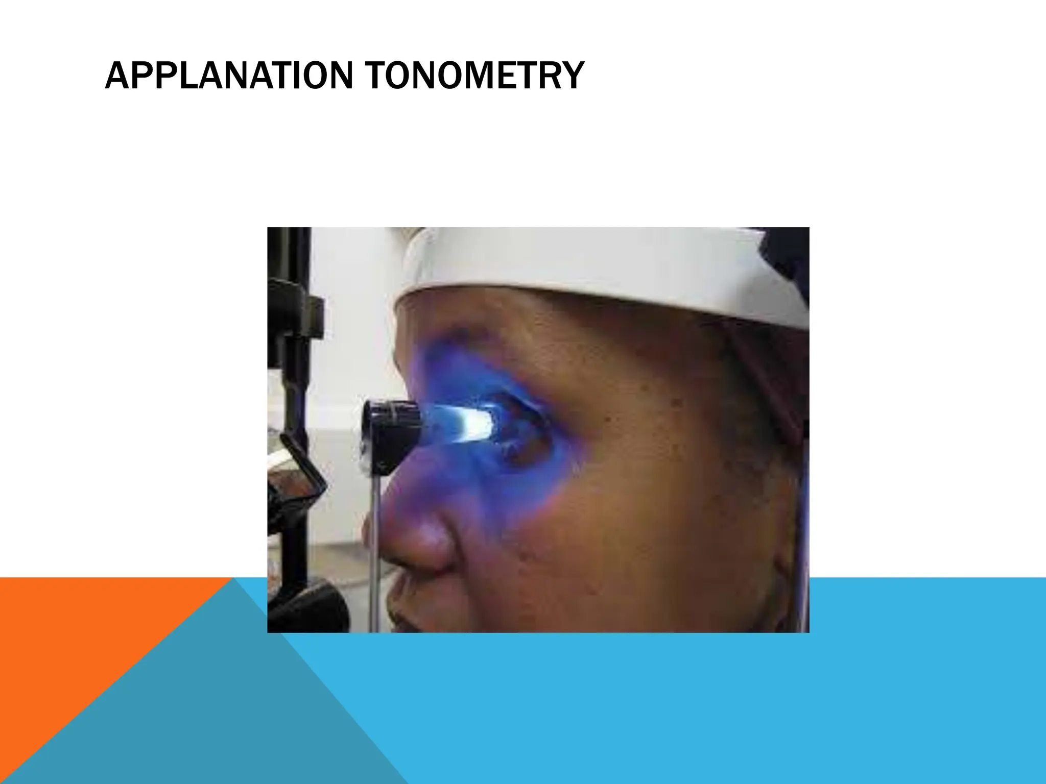 Glaucoma ophthalmology diagnosis ,signs,ttt | PPT