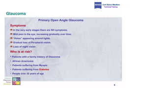 GLAUCOMA of human eye for certificate nurses | PPTX