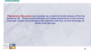 GLAUCOMA of human eye for certificate nurses | PPTX