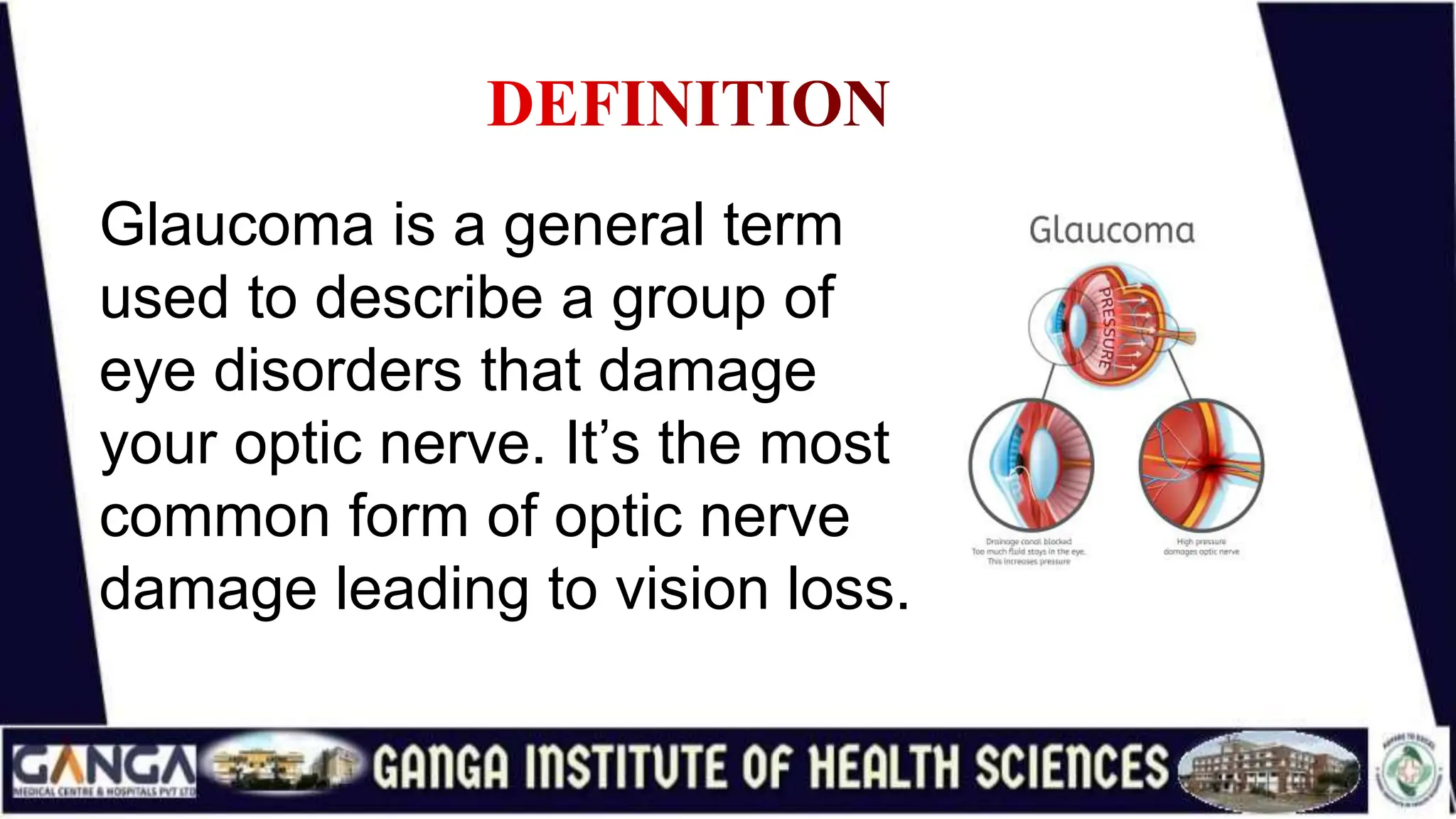 glaucoma and its management.pptx for nursing students | PPTX