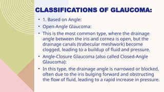 GLAUCOMA and its classification ppt | PPTX