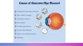 GLAUCOMA.pptx PPT | PPTX