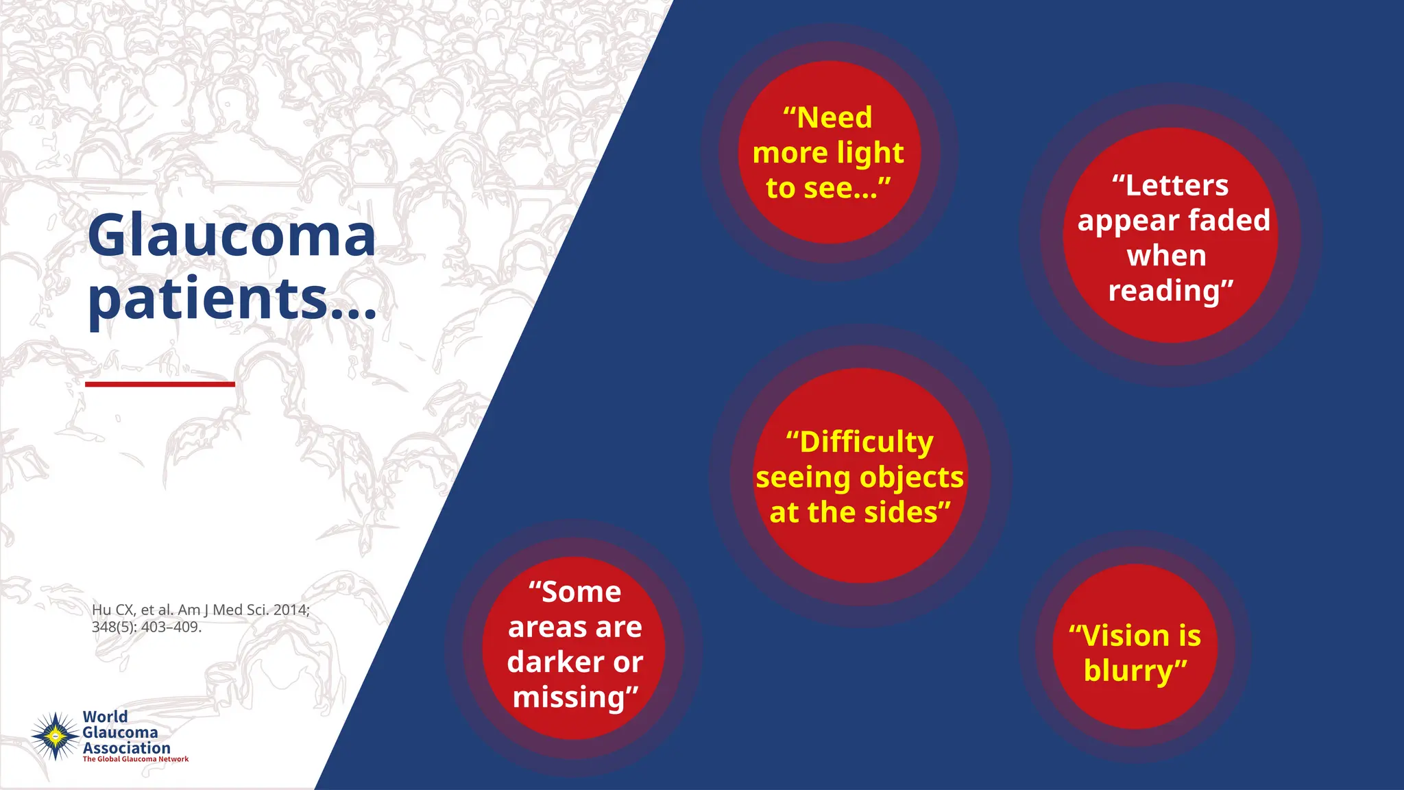 Glaucoma-Awareness estadisticas a nivel mundial.pptx