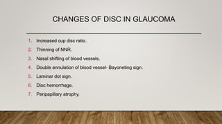 Glaucoma dr.eqbal | PPTX