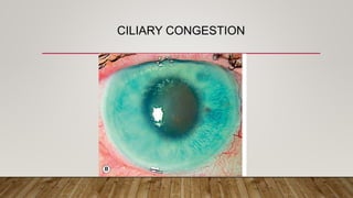 Glaucoma dr.eqbal | PPTX