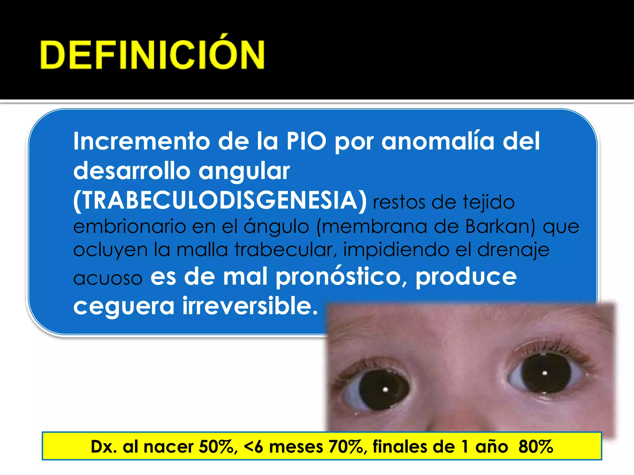 Glaucoma evaluación del nervio óptico, glaucoma neonatal y manitol | PPT