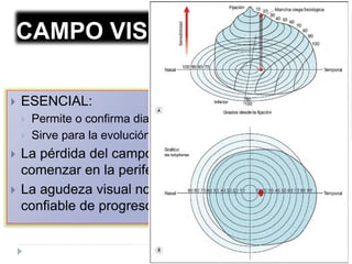 Glaucoma evaluación del nervio óptico, glaucoma neonatal y manitol | PPTX