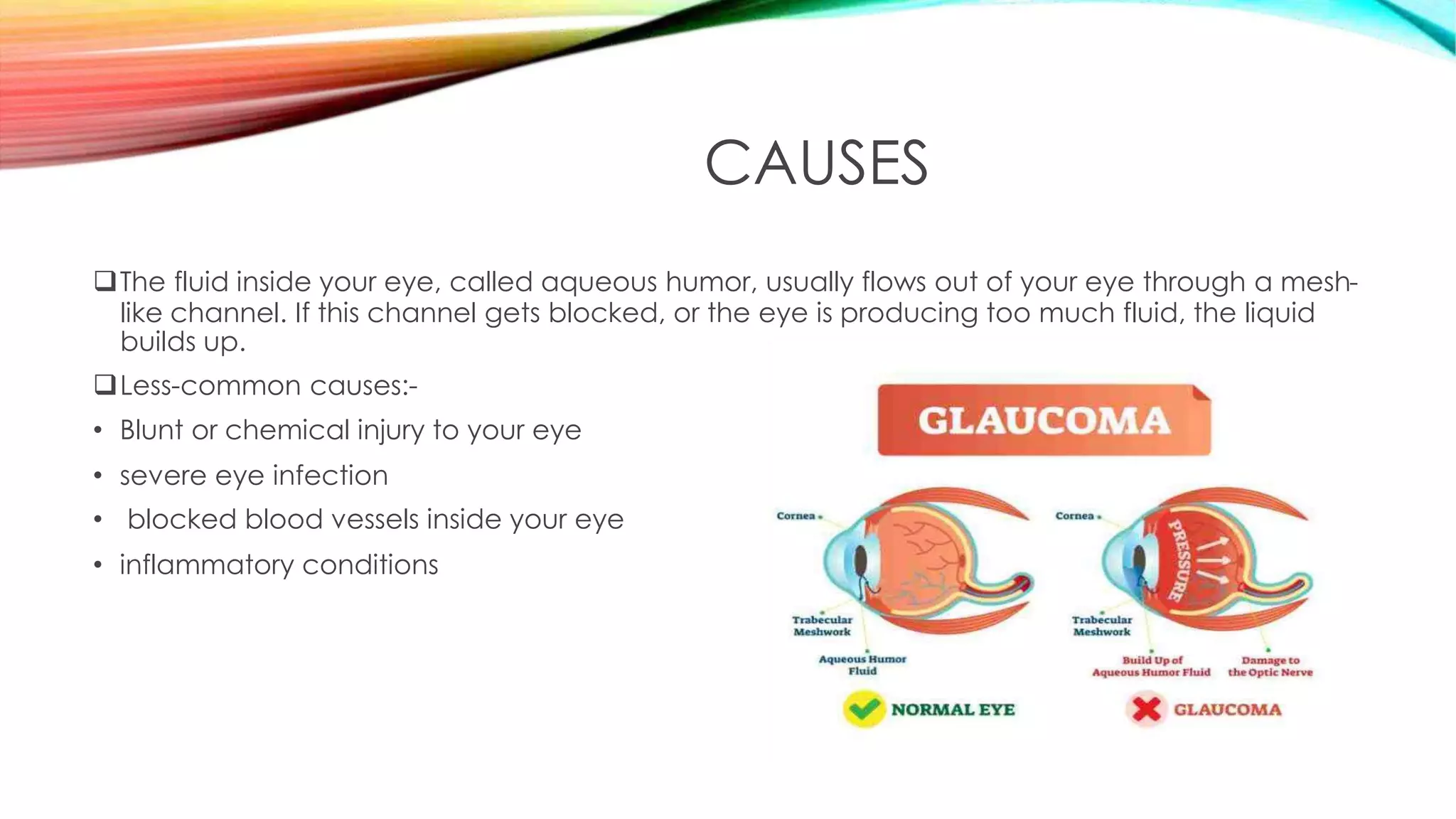 glaucoma-final.pptx