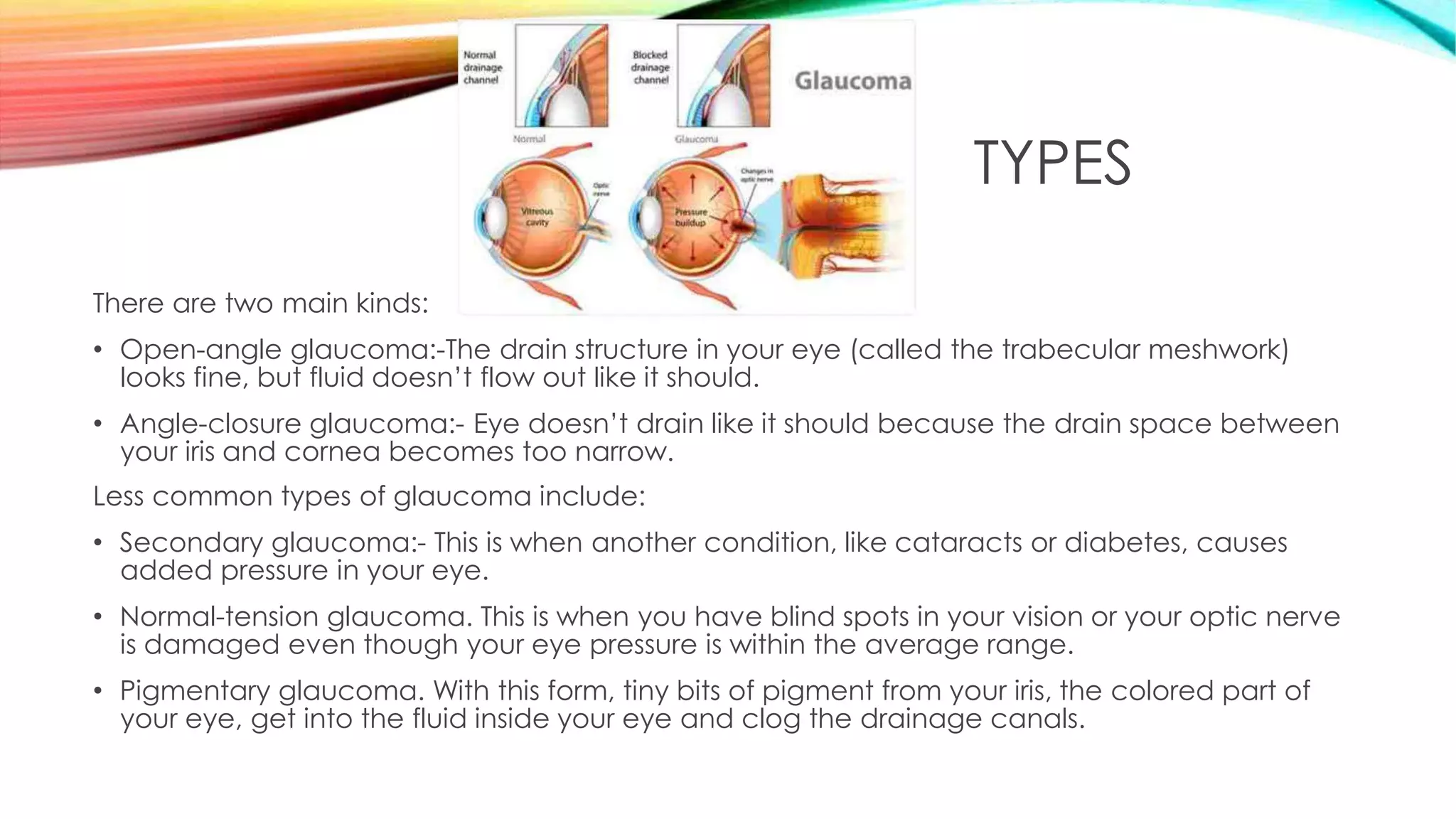 glaucoma-final.pptx