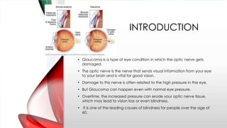 glaucoma-final.pptx