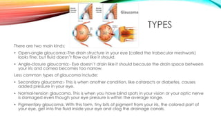 glaucoma-final.pptx