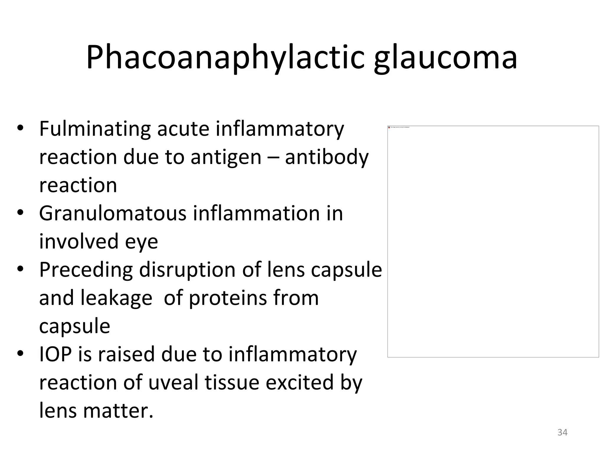 Glaucoma-Presentation new (2).pptx