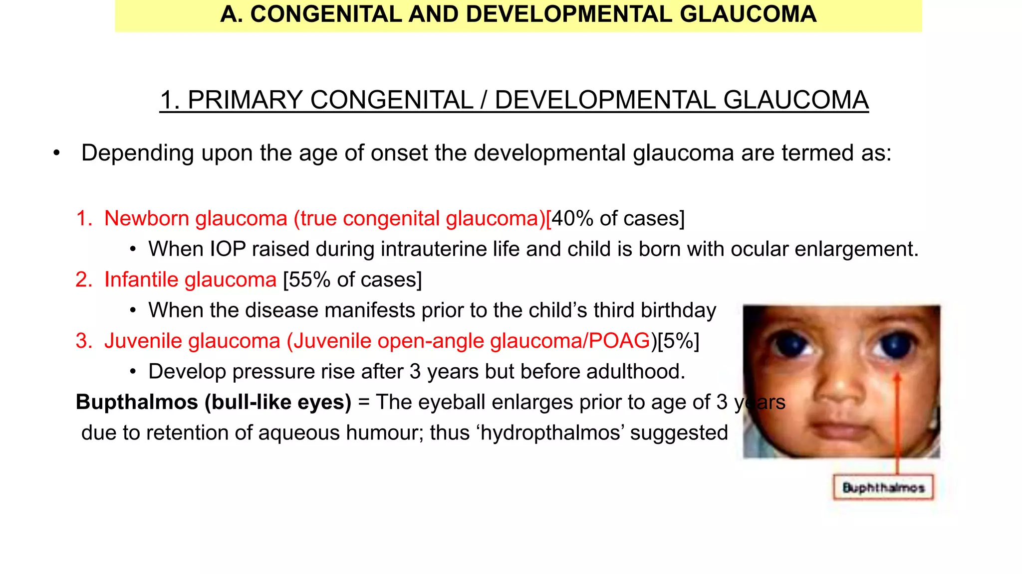 Glaucoma | PPTX