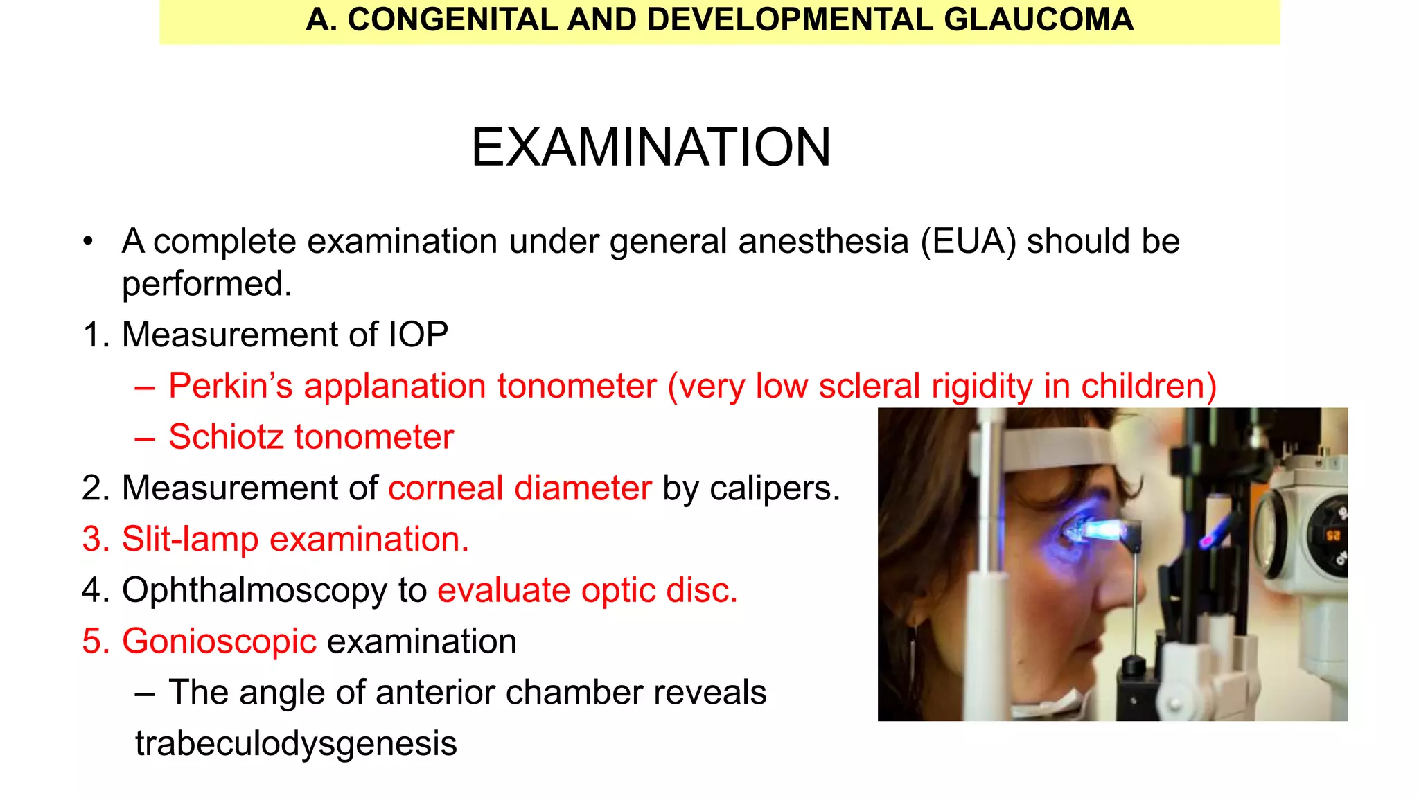 Glaucoma | PPTX