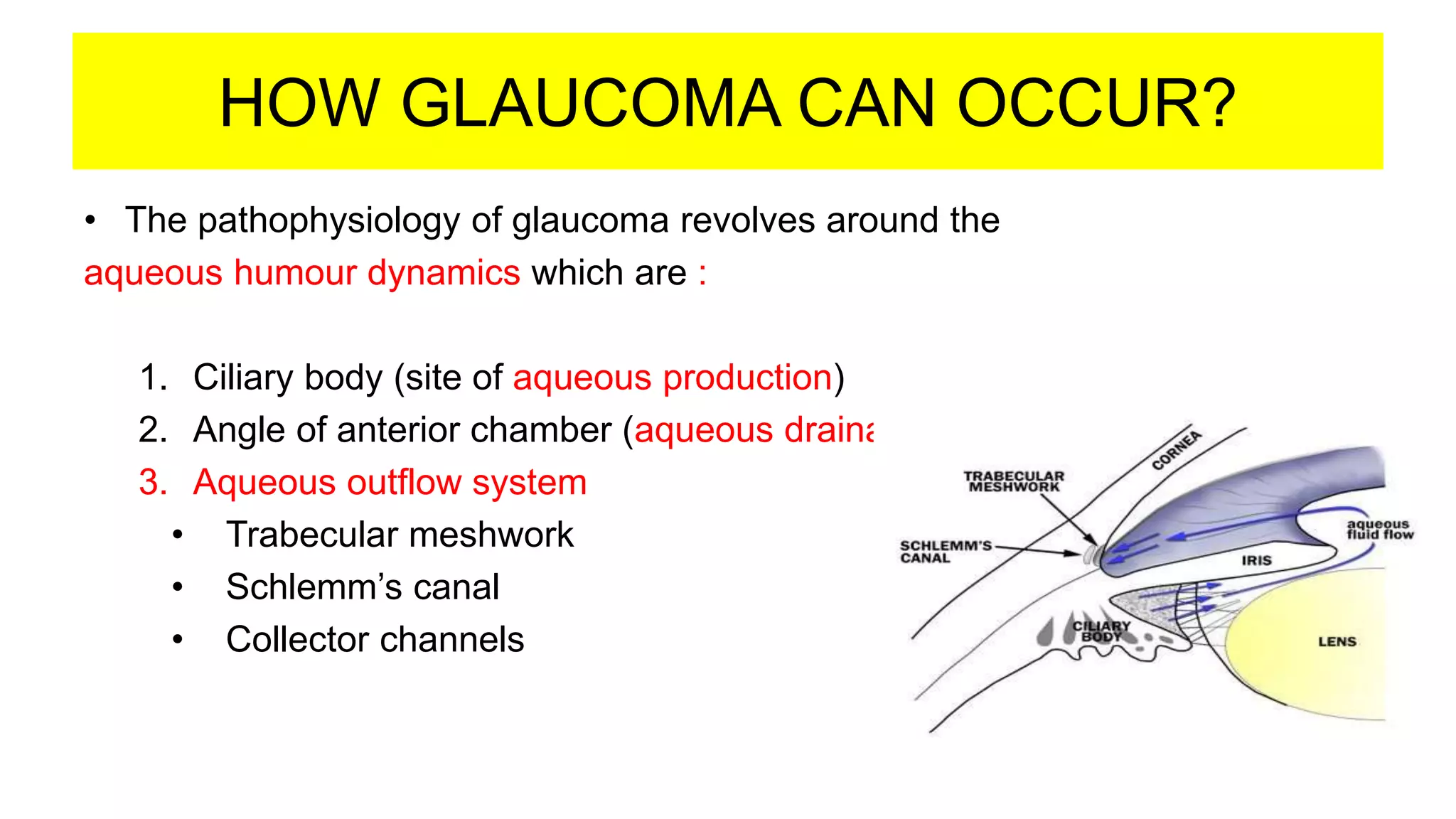 Glaucoma | PPTX
