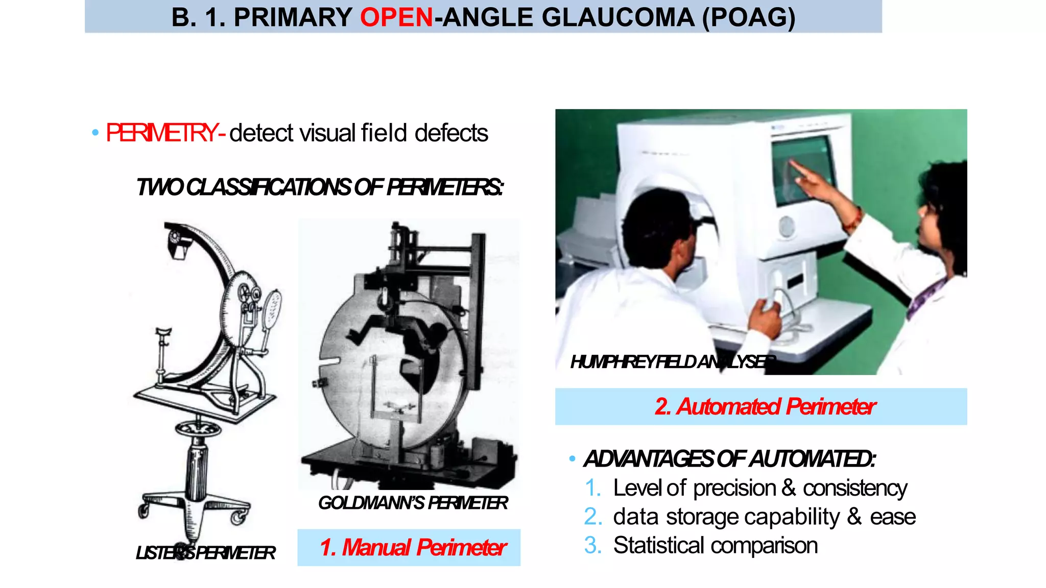 Glaucoma | PPTX