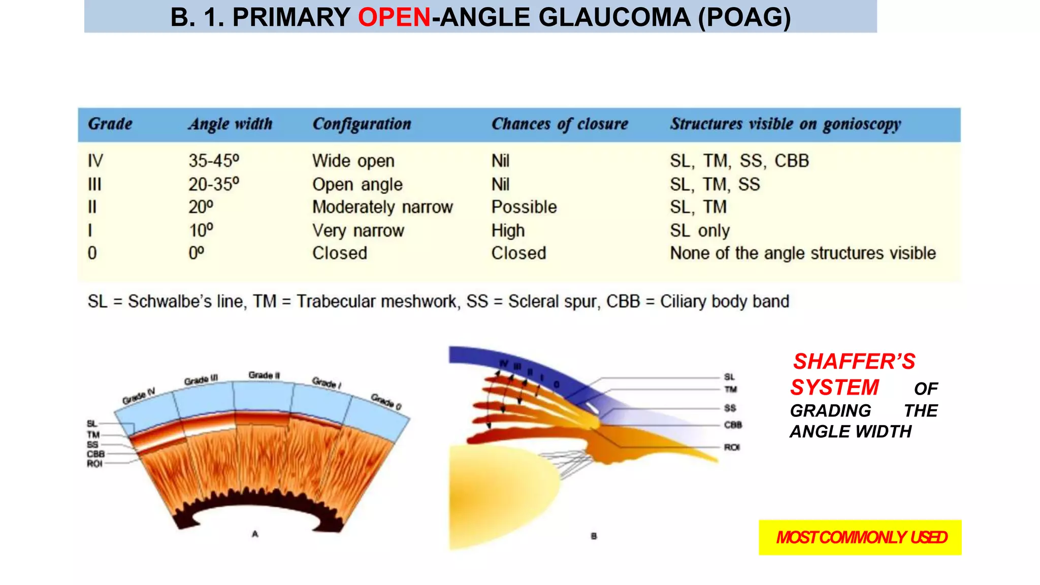 Glaucoma | PPTX