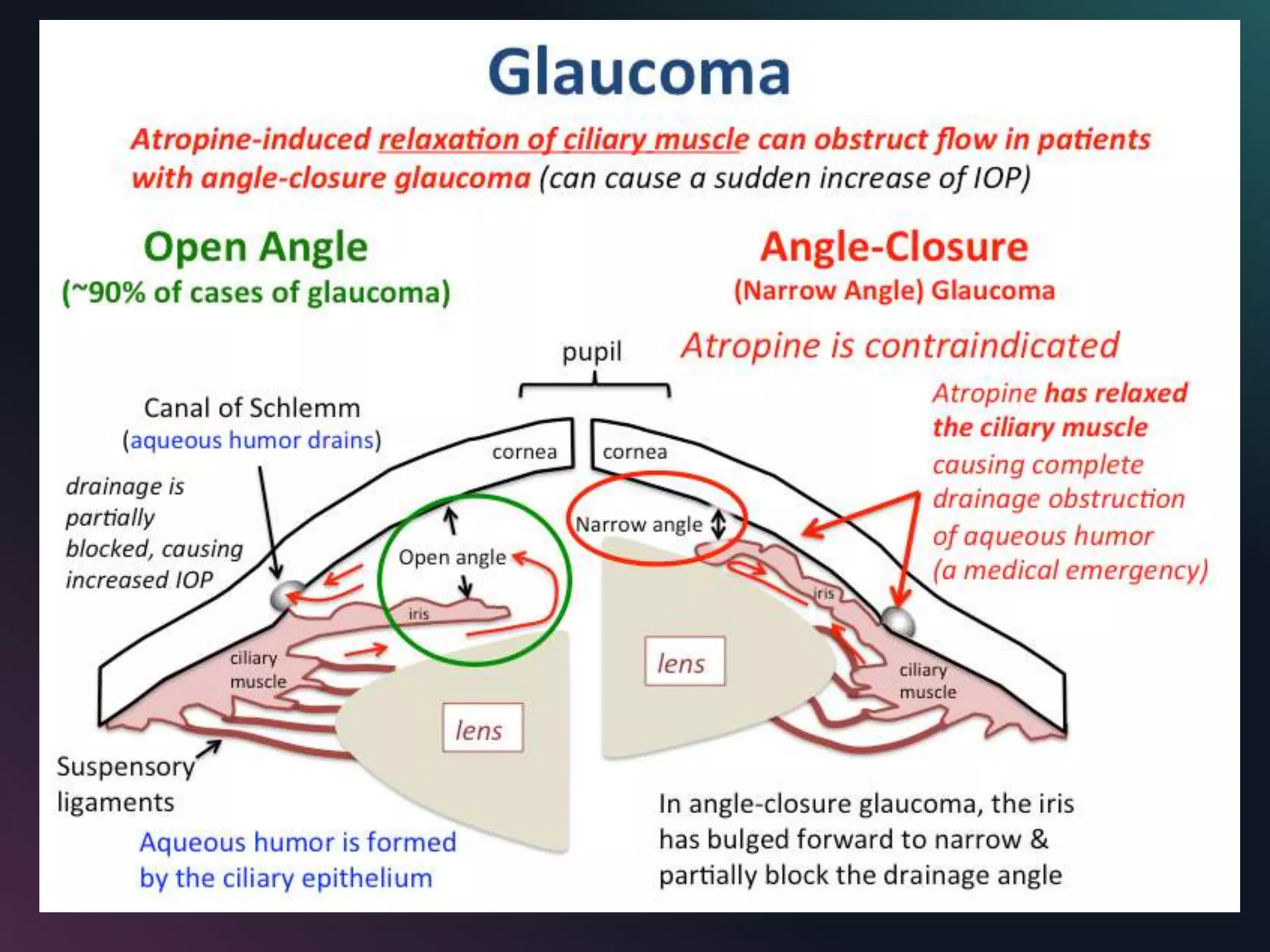 Glaucoma 1 dr v r patkar | PPTX