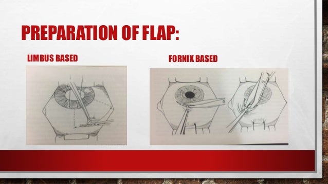 surgical management of glaucoma