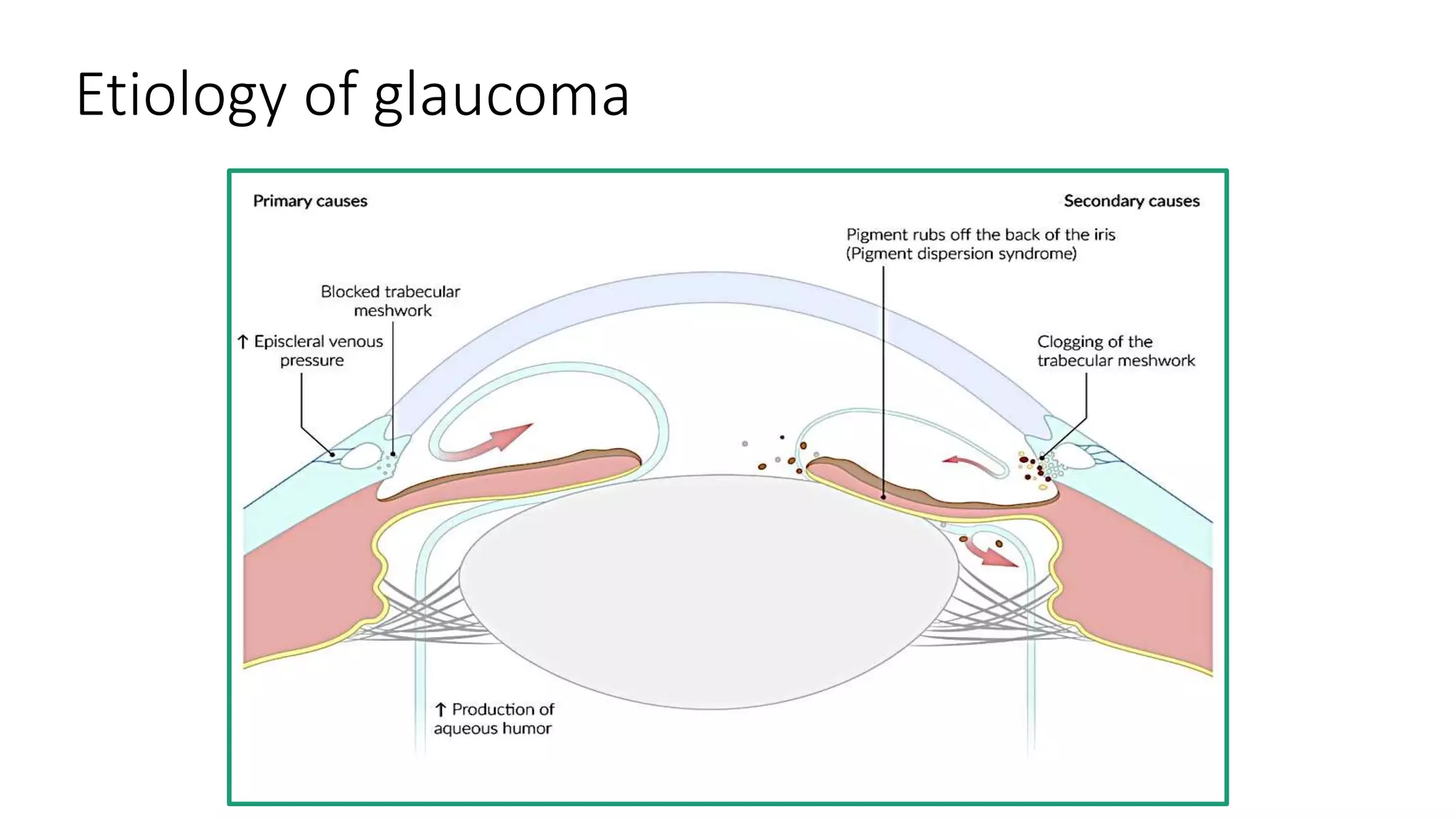Pharmacotherapy of Glaucoma .pptx