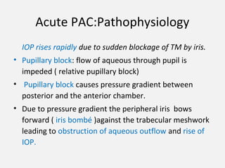 Glaucoma 2 primary angle closure glaucoma,dr.k.n.jha,02.11.16
