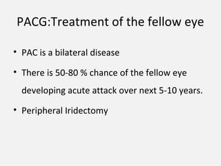 Glaucoma 2 primary angle closure glaucoma,dr.k.n.jha,02.11.16