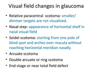 Glaucoma 3 primary open angle glaucoma,dr.k.n.jha, 03.11.16 | Eye and ...