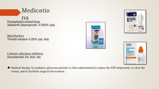 Congenital Glaucoma | PPTX