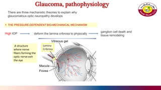 Glaucoma, all what you have to know about. | PPTX