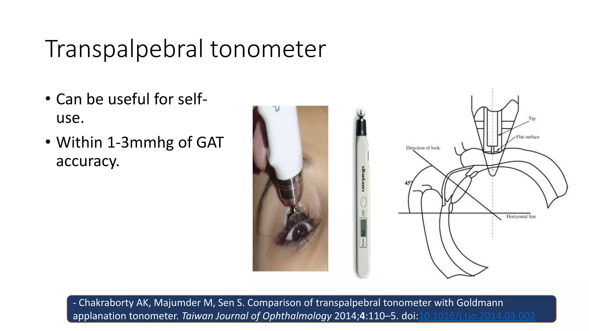 Glaucoma post cataract extraction, vitreoretinal surgery, keratoplasty ...