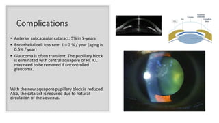 Glaucoma post cataract extraction, vitreoretinal surgery, keratoplasty ...