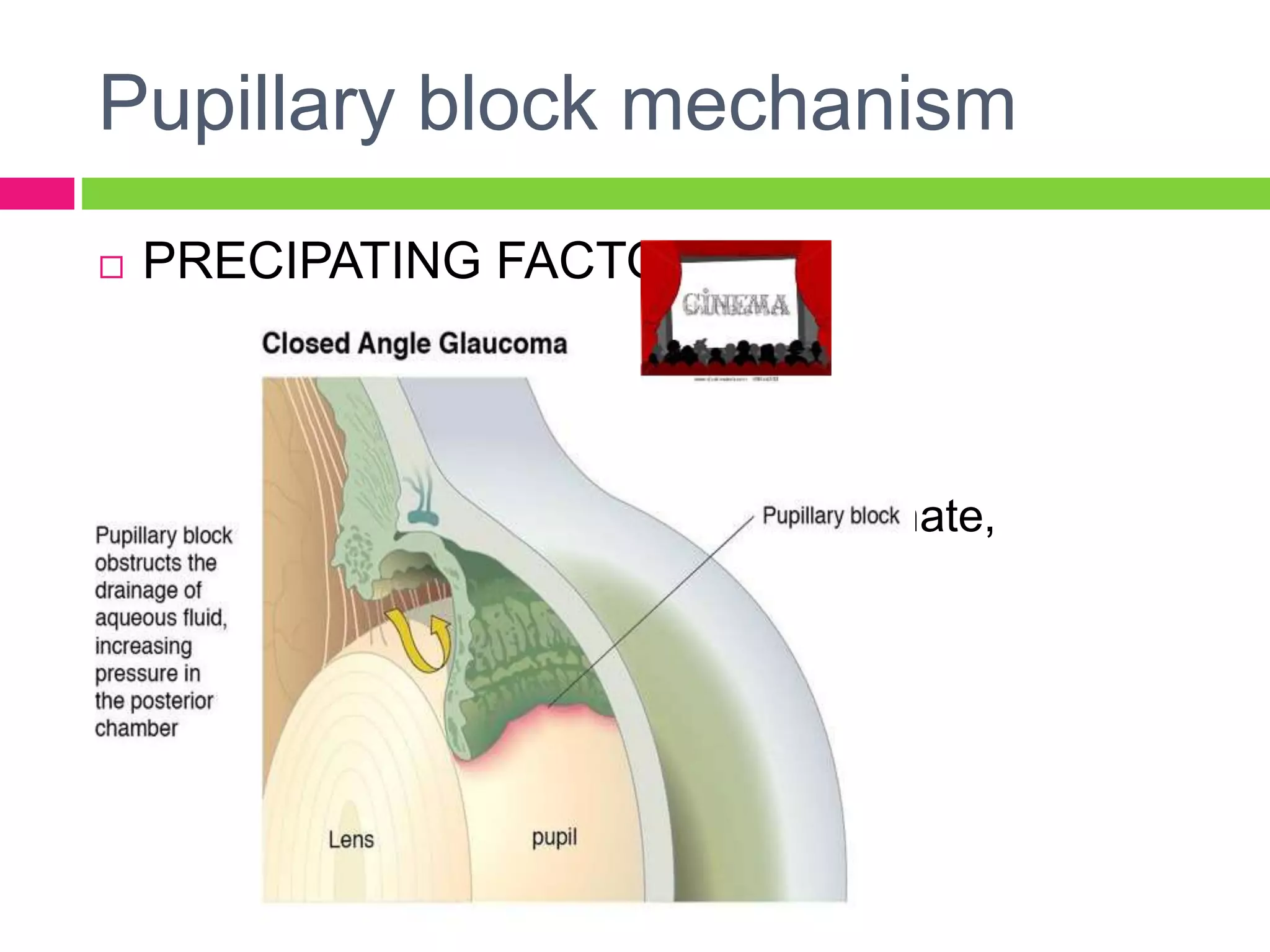 Glaucoma primary closed angle,secondary glaucoma, congenital glaucoma ...