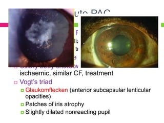Glaucoma primary closed angle,secondary glaucoma, congenital glaucoma ...